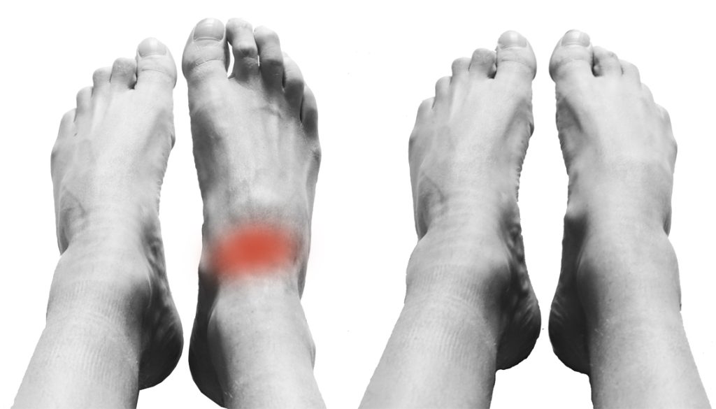 Douleurs cheville et pied. Reboutement : traitement et guérison